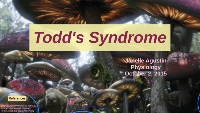 Todd's Syndrome by Janelle Agustin on Prezi