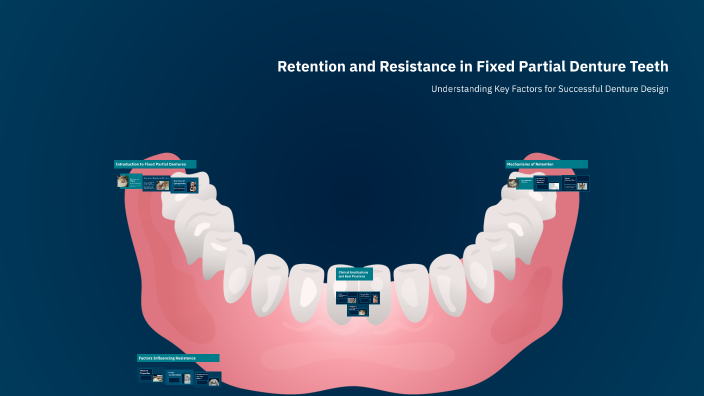 Retention and Resistance in Fixed Partial Denture Teeth by steven ...