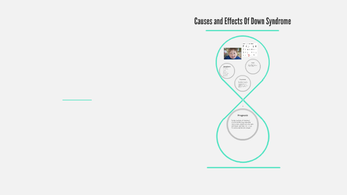 Causes and Effects Of Down Syndrome by olga robleto on Prezi
