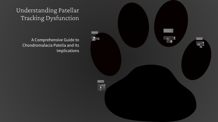 Understanding Patellar Tracking Dysfunction by Shima Mohseni on Prezi