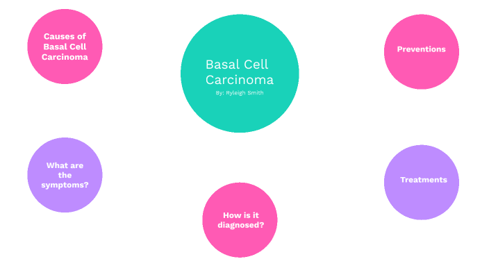 Basal Cell Carcinoma by Ryleigh Smith on Prezi
