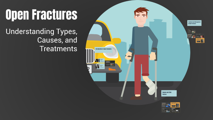 Open Fractures by Gais Gais Mohammed on Prezi