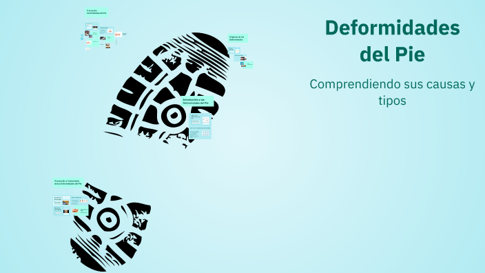 Deformidades del Pie by Greta Rivas on Prezi