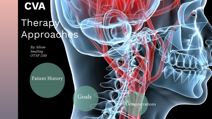 OTAP 1350 Case Study by Allison Smalling on Prezi