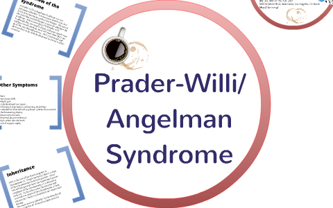 Prader-Willi/Angelman Syndrome Presentation by Nathaniel Maxcy on Prezi