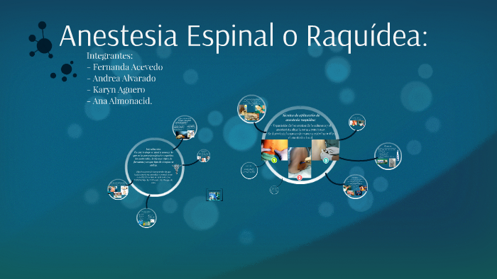 Anestesia Espinal o Raquídea: by Ana Almonacid on Prezi