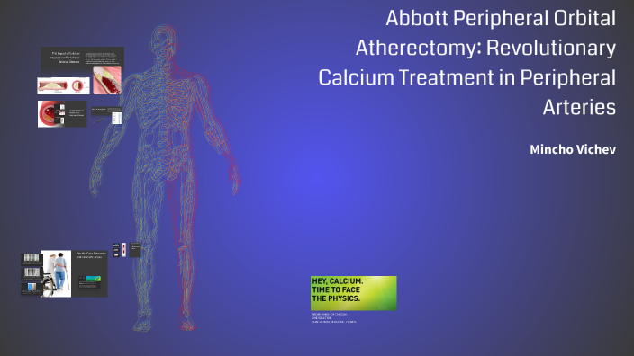 Abbott Peripheral Orbital Atherectomy System: A Revolutionary Approach ...