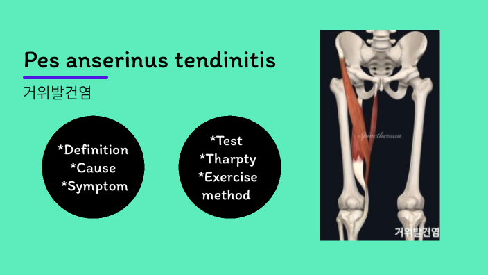 Pes Anserinus Tendittitis by 시은 김 on Prezi