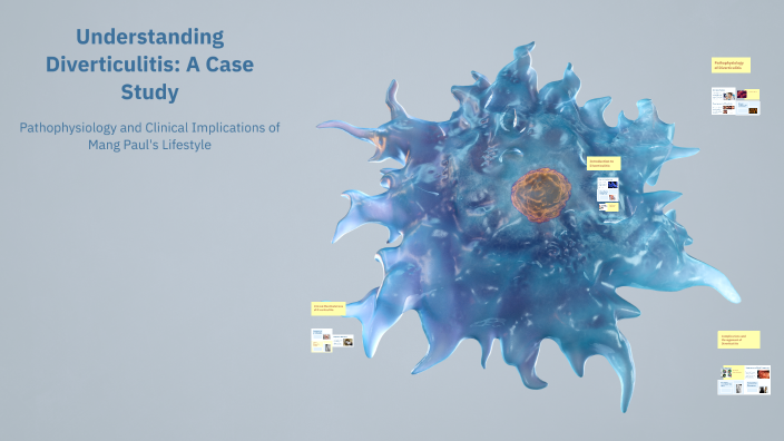 Understanding Diverticulitis: A Case Study by John Michael Blacer on Prezi