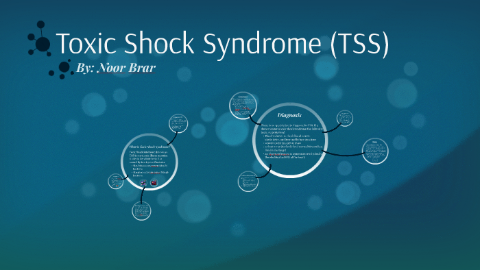Toxic Shock Syndrome Tss By Noor Brar