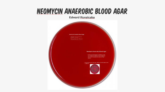 NEOMYCIN B.Agar by edward ruvalcaba on Prezi