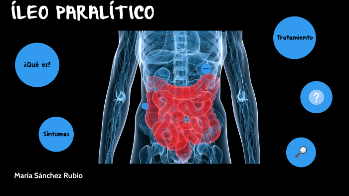 ÍLEO PARALÍTICO by María Sánchez Rubio on Prezi