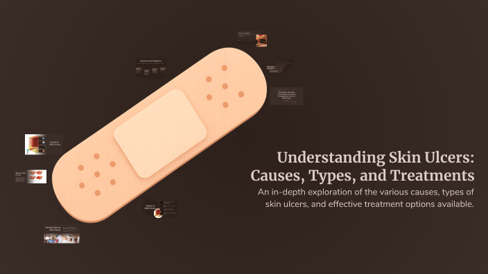 Understanding Skin Ulcers: Causes, Types, and Treatments by Kim Vincent ...