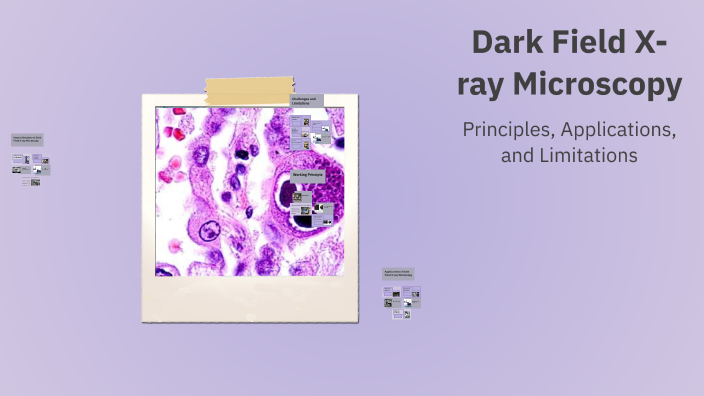 Dark Field X-ray Microscopy by Anishka P S (P24CI0201) on Prezi