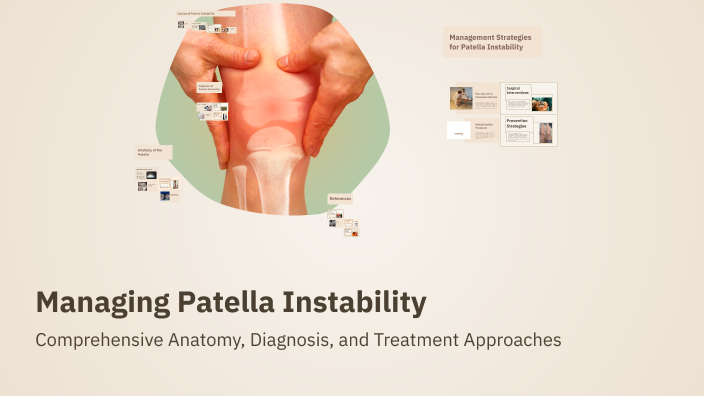 Managing Patella Instability by Tashi Torres on Prezi
