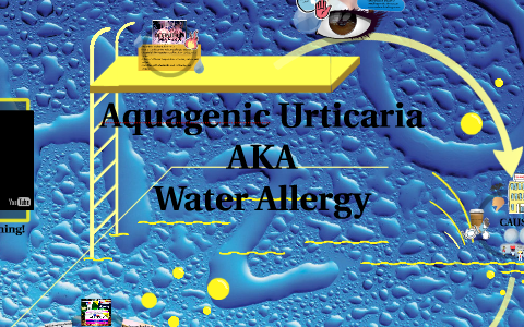 Aquagenic Urticaria AKA Water Allergy by Zakirah Rostom on Prezi