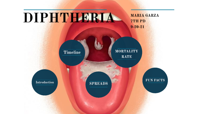 Diphtheria Symptoms