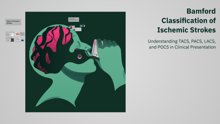 Bamford Classification of Ischemic Strokes by Jessica Eastwood on Prezi