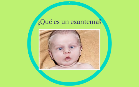 ¿Qué es un exatema? by erika fernandez