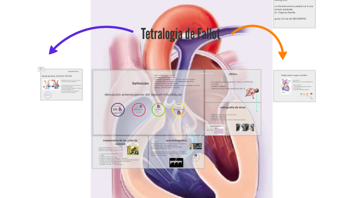 TETRALOGIA DE FALLOT by cecilia waquim on Prezi