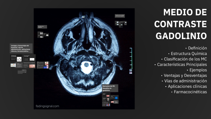 MEDIO DE CONTRASTE GADOLINIO by Mario Pérez on Prezi