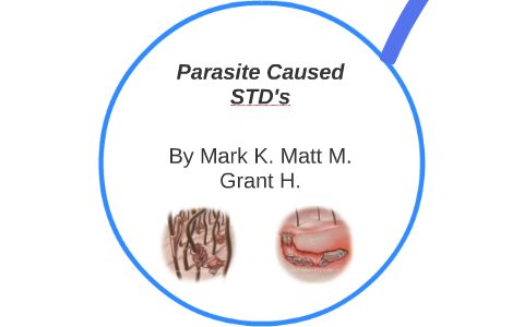 Parasite Caused STD's by Mark Knapp on Prezi