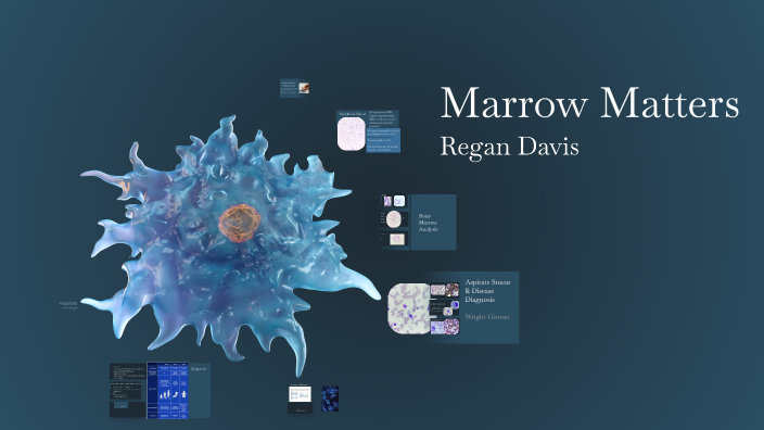 611 Hematology - Varner Case Study by Regan Davis on Prezi