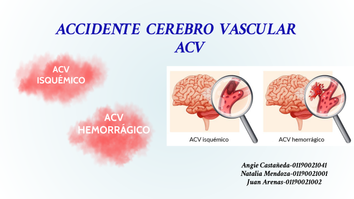 ACV ISQUEMICO Y HEMORRAGICO by Angie Rodriguez on Prezi