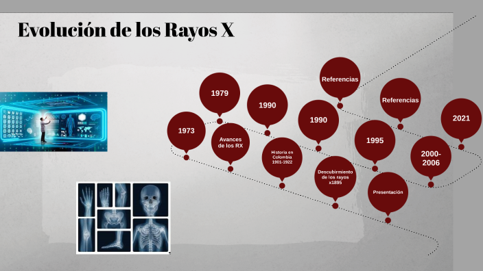 Evolución De Los Rayos X by julieth aguilera on Prezi