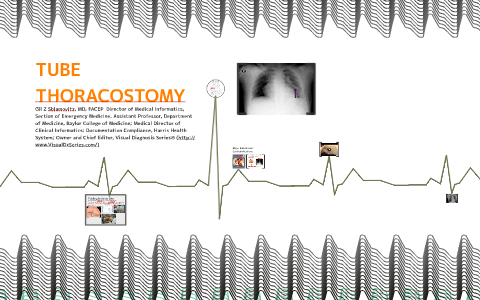 Tube Thoracostomy by Dylan Marker on Prezi