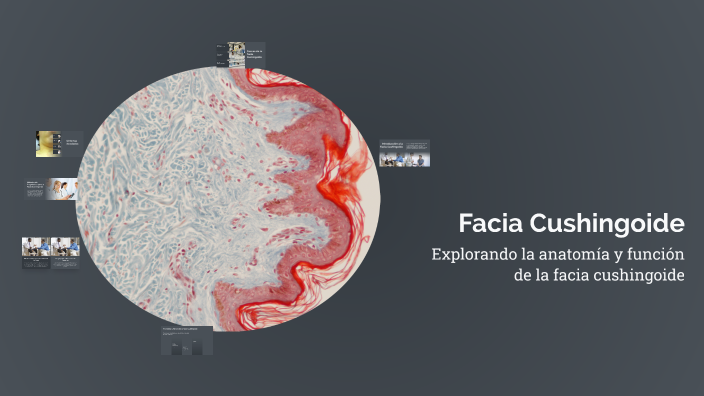 Facia Cushingoide by RONALD YOMAR VILCA CONDOR on Prezi