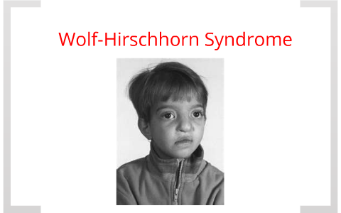Wolf-hirschhorn syndrome by blake king on Prezi
