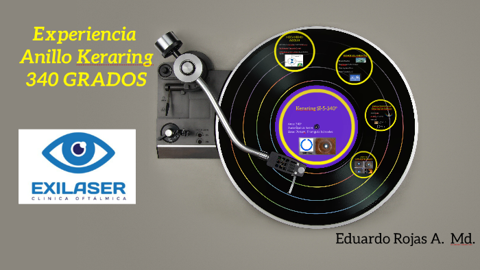 ANILLO 340 GRADOS by Giuseppe Miotto on Prezi