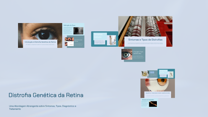 Distrofia Genética da Retina by mariana melo on Prezi