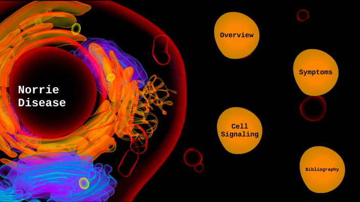 Norrie Disease by Ella Shaffer on Prezi