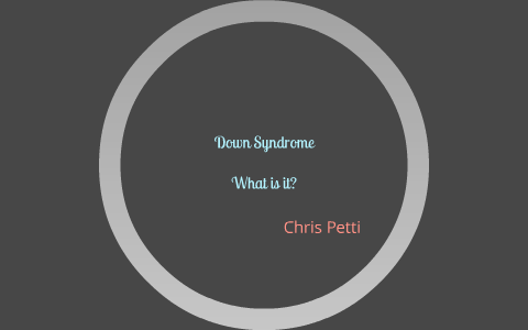 Down Syndrome by Chris Petti on Prezi