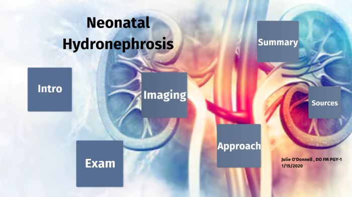 Neonatal Hydronephrosis by Julie O'Donnell on Prezi