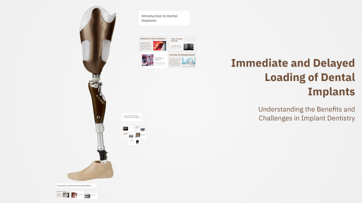 Immediate and Delayed Loading of Dental Implants by عبدربه عمار on Prezi