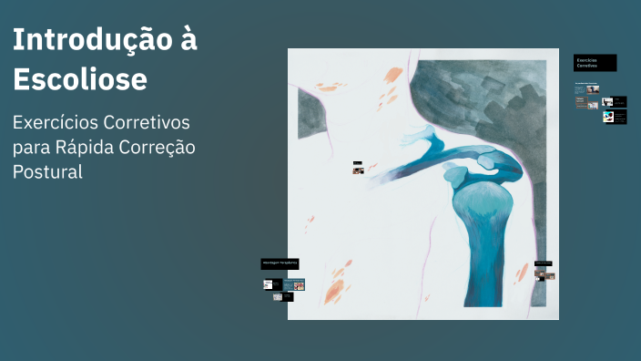 Introdução à Escoliose by Levi Brito on Prezi
