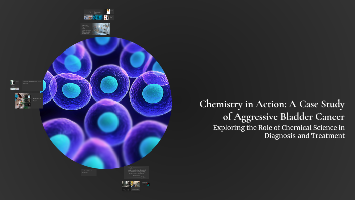 Chemistry in Action: A Case Study of Aggressive Bladder Cancer by ...