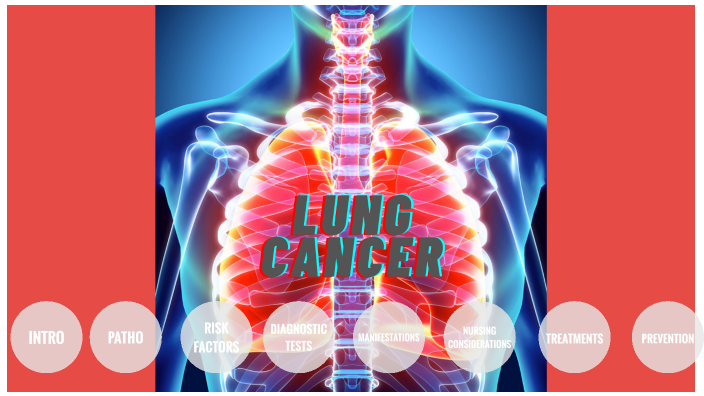 Lung Cancer Concept Map by Juilene Walker on Prezi