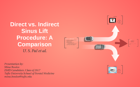 Direct vs. Indirect Sinus Lift Procedure: A Comparison by Mina Boulos ...
