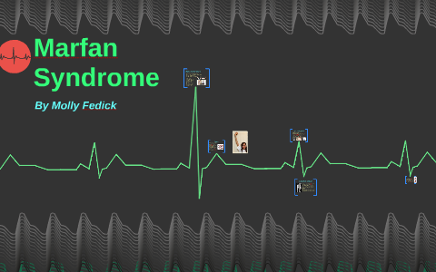 Marfan Syndrome by Molly Fedick on Prezi