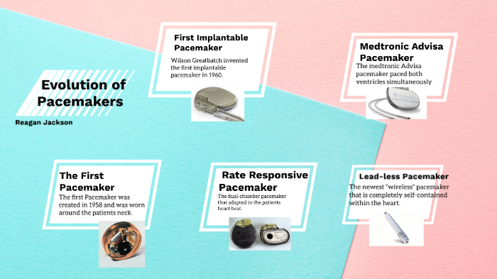 evolution of pacemakers by Reagan Jackson on Prezi