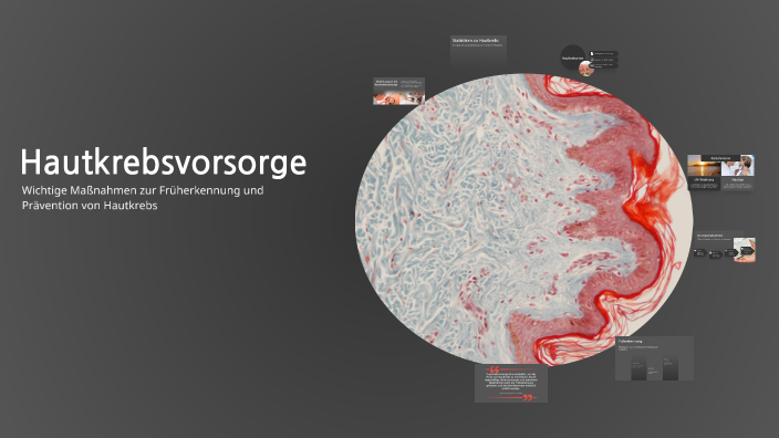 Hautkrebsvorsorge by Cheyenne Pohl on Prezi
