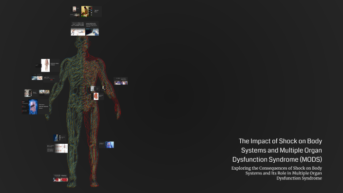 The Impact of Shock on Body Systems and Multiple Organ Dysfunction ...