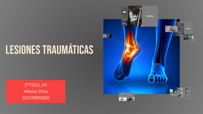 Lesiones traumáticas by Milena Zhou on Prezi