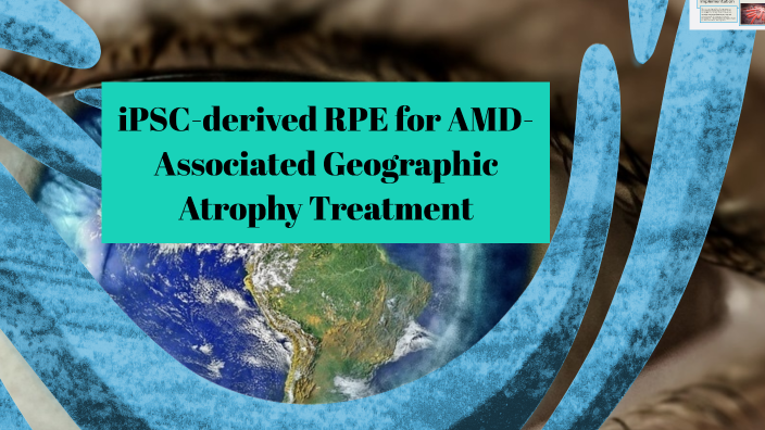 iPSC-derived RPE for AMD-Associated Geographic Atrophy Treatment by on ...