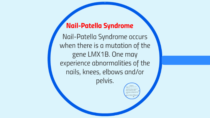 Chromosome 9 Disorders by Tori Hegarty