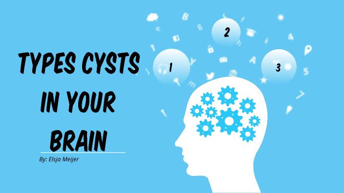 Three Types of Brain Cysts by Elsja Meijer on Prezi